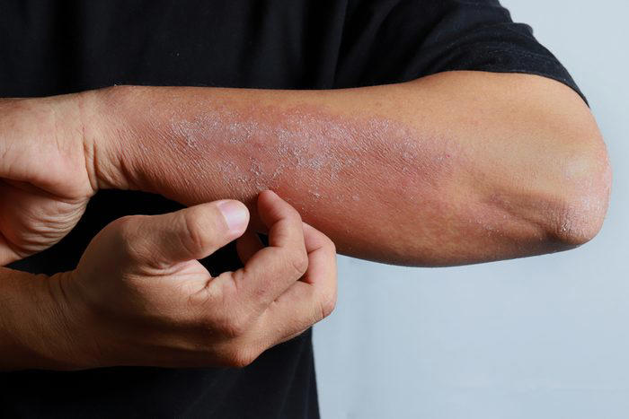 The 10 Itches You Should Never, Ever Scratch