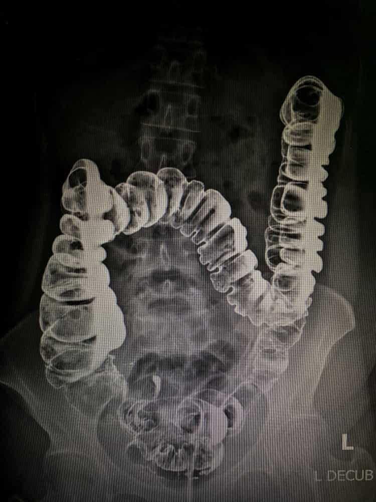 Cancer screening: what tests you should be doing and when