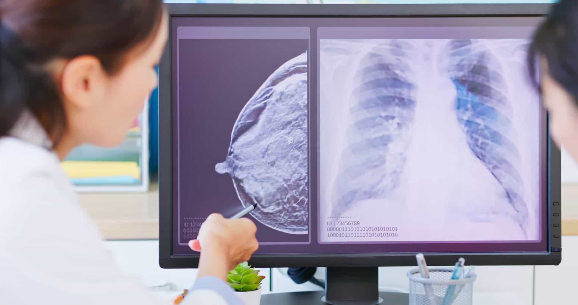 Cancer screening tests: When should you do them?