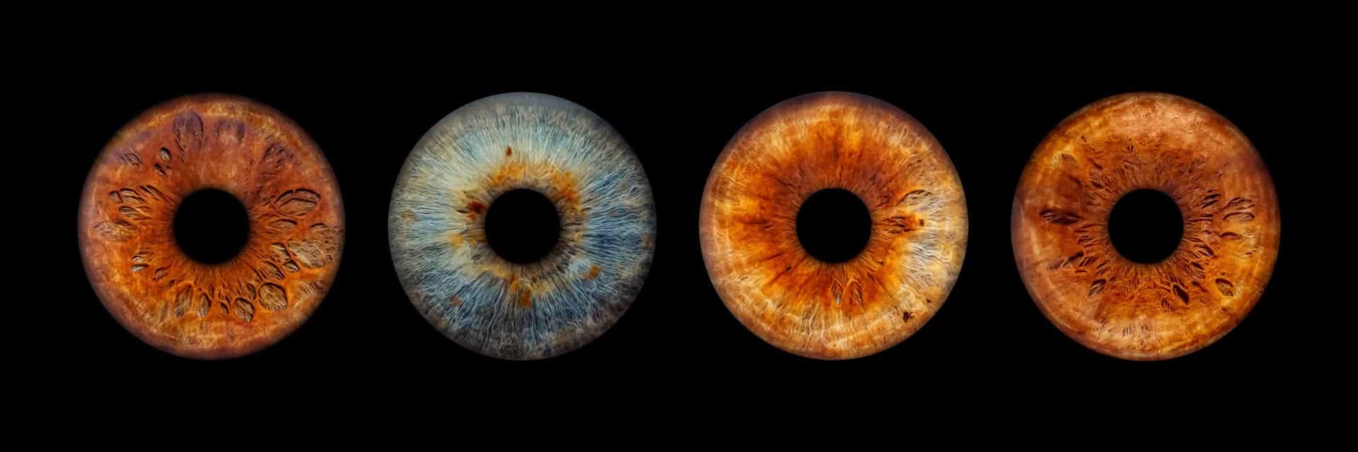 How adult eyes change color
