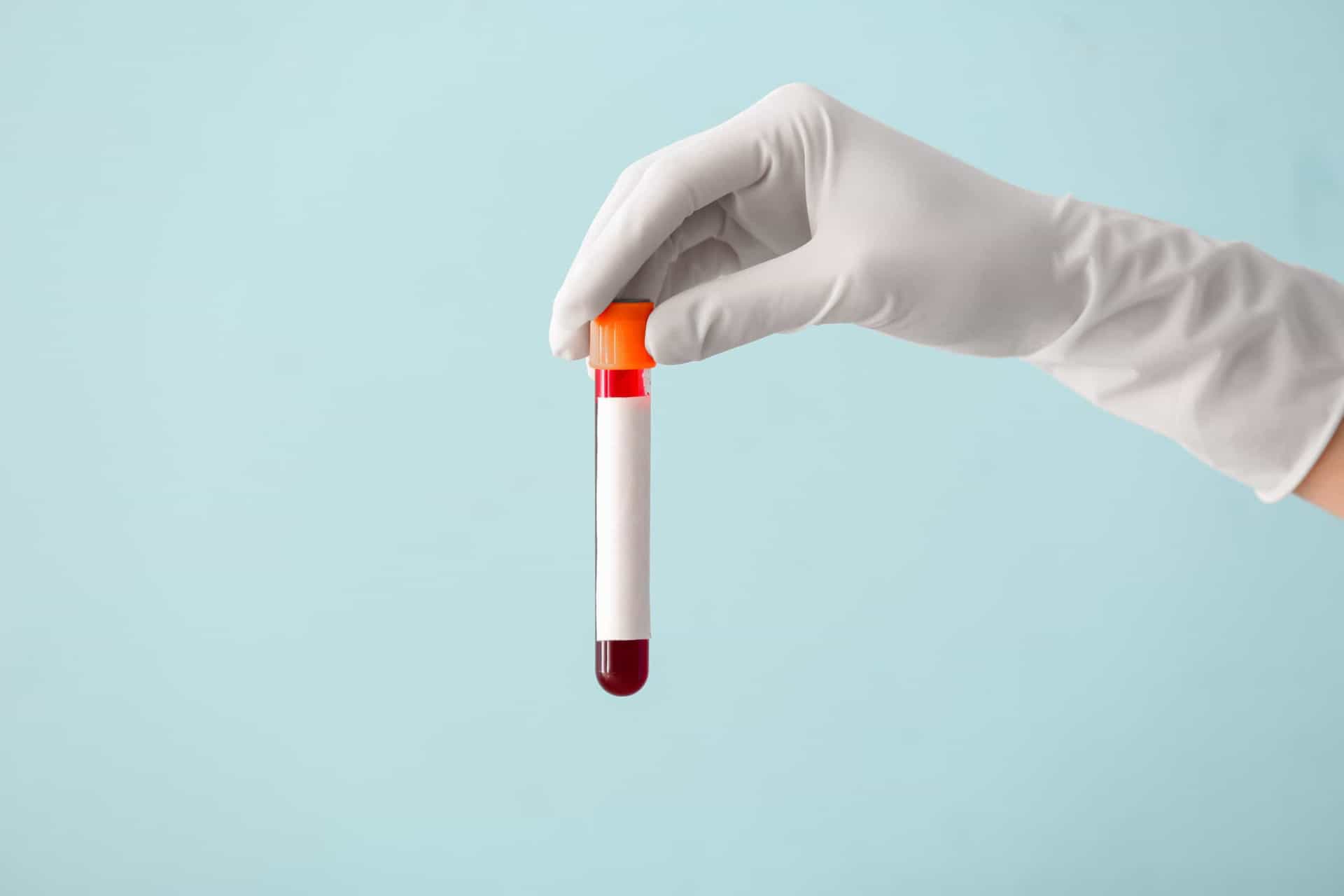 This is how your blood type can affect your health