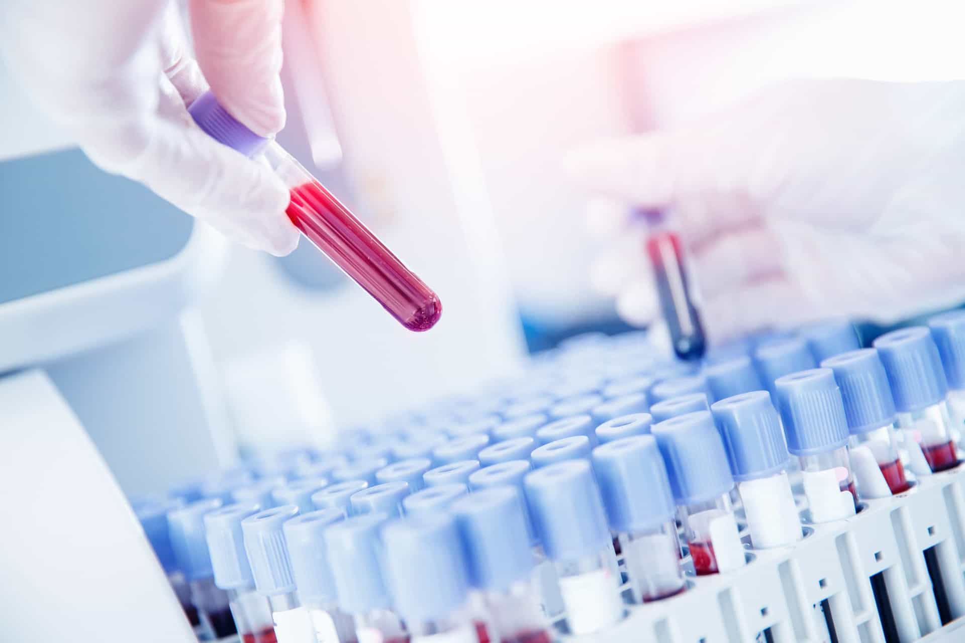 This is how your blood type can affect your health