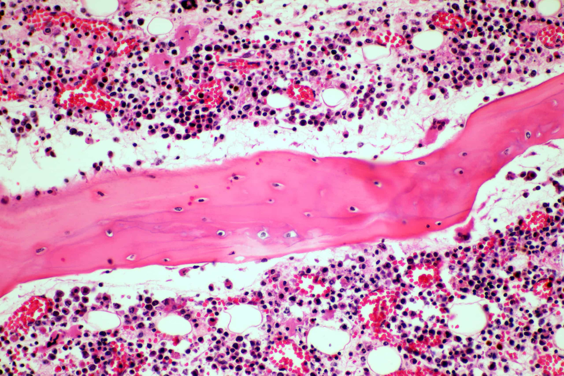 Rare cancers that challenge the medical profession