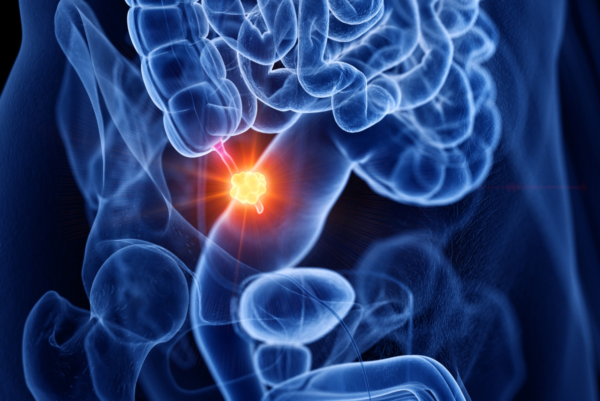 Rare cancers that challenge the medical profession