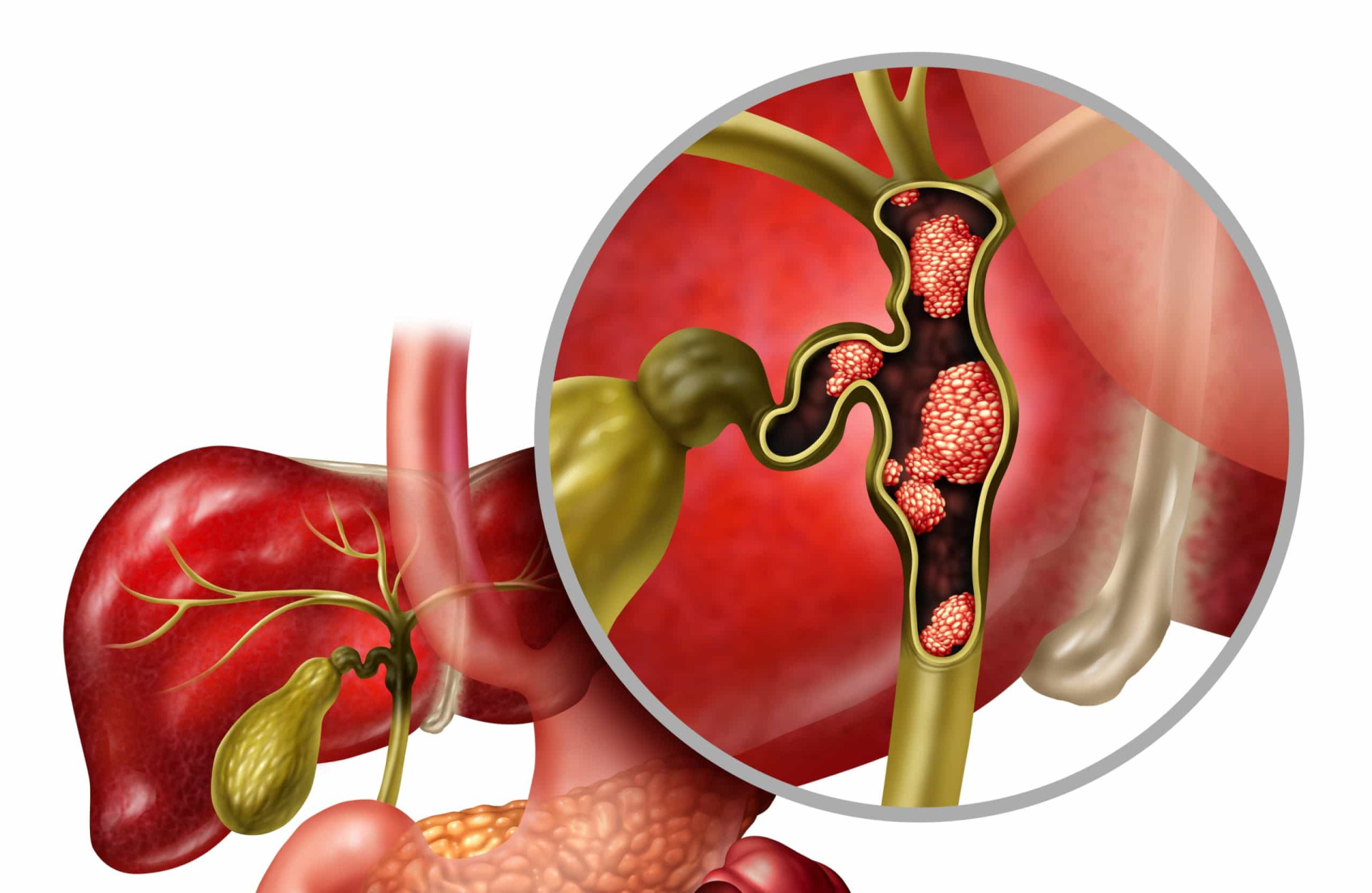 Rare cancers that challenge the medical profession