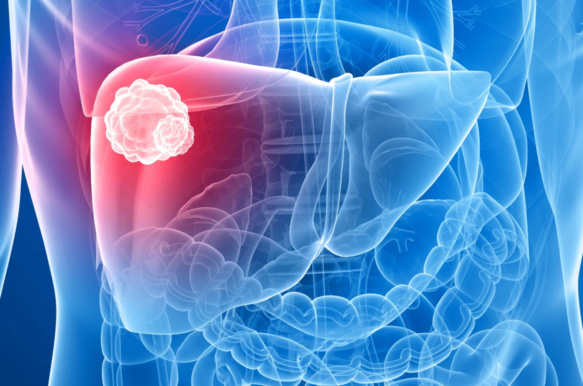 Rare cancers that challenge the medical profession