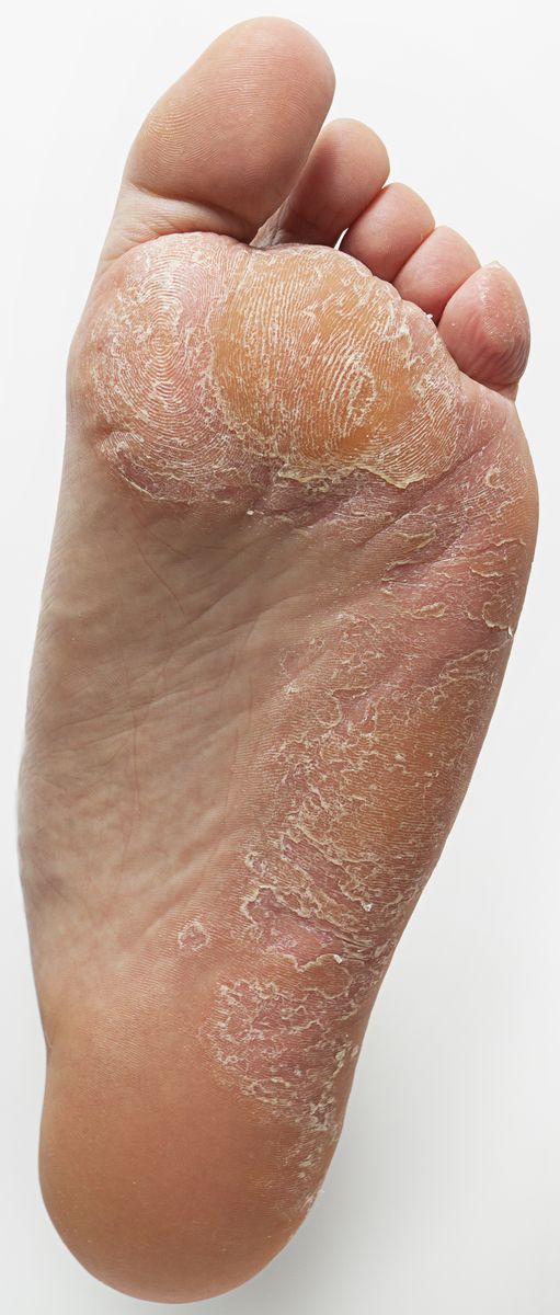 These Pictures Will Help You Identify the Most Common Skin Rashes