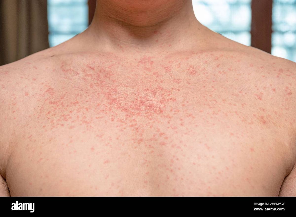 These Pictures Will Help You Identify the Most Common Skin Rashes