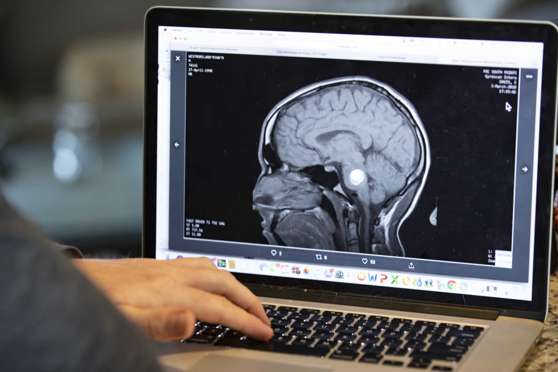 The life-changing ways exercise modifies your brain