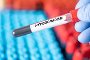 Signs That You May Have Low Testosterone even If You Are A Woman 