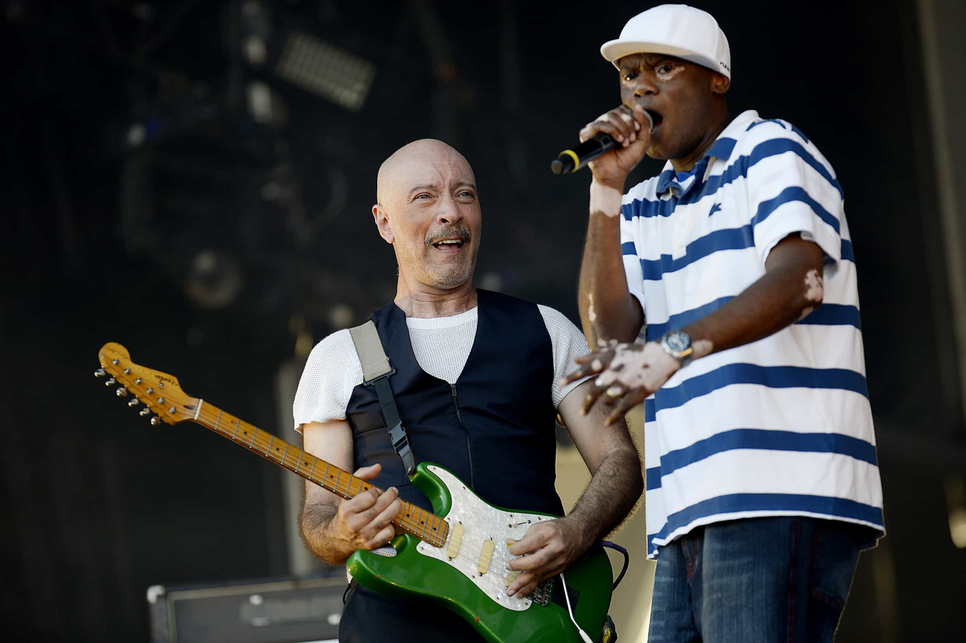 Famosos que têm vitiligo e venceram o preconceito!