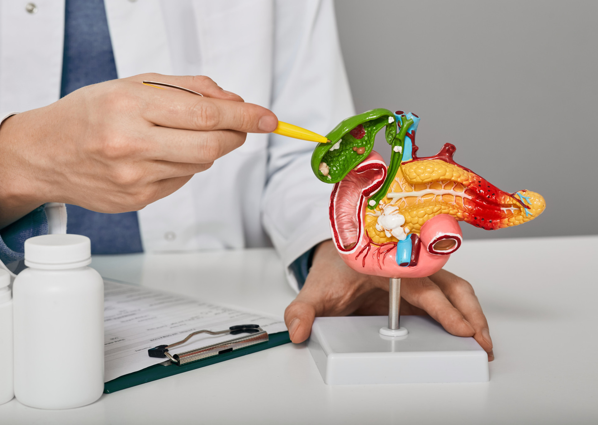 Cholangiocarcinoma: the bile duct cancer with a low survival rate