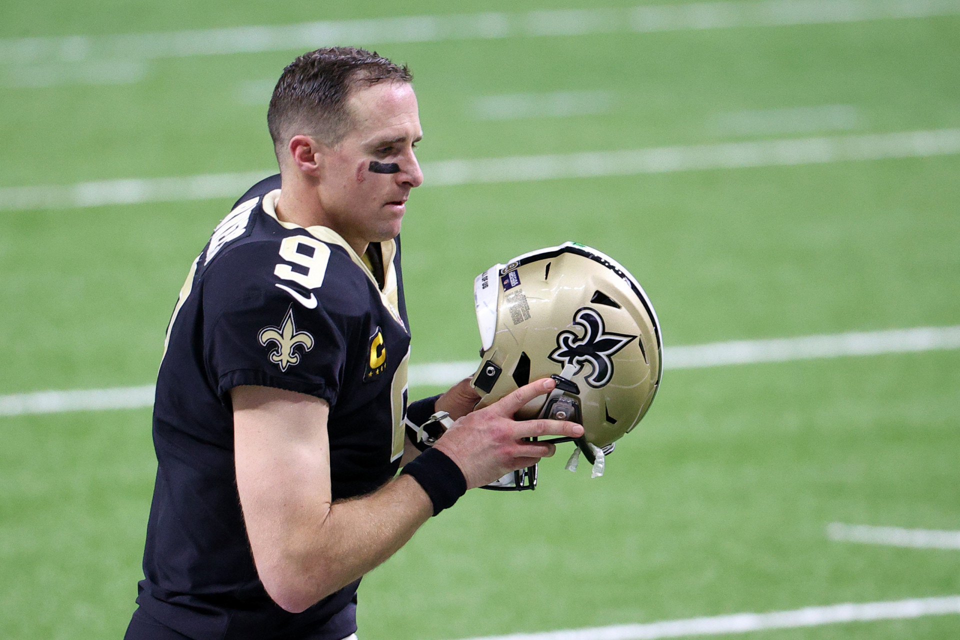 Birthmarks and the celebrities who embrace theirs