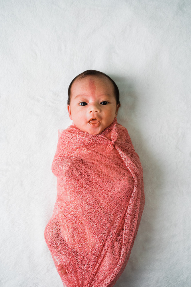 Birthmarks and the celebrities who embrace theirs