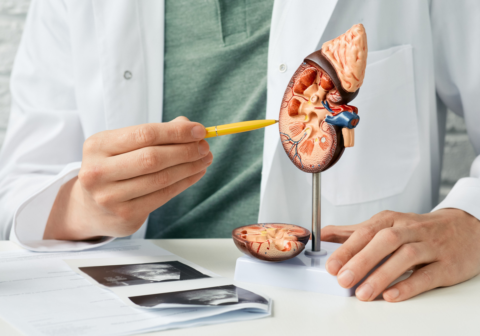 Are you taking care of your kidneys?