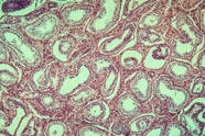 Do You Know The Warning Signs Of Testicular Cancer 