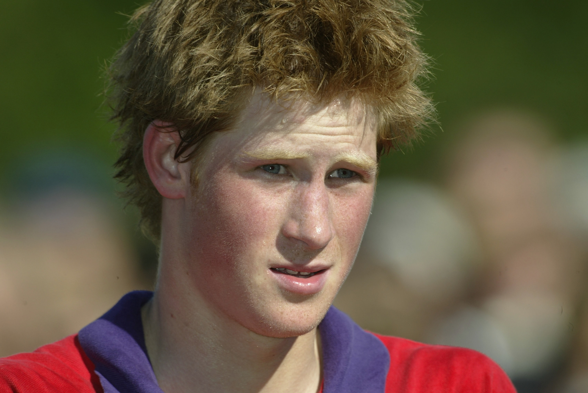 Prince Harry creates boost to beard transplants