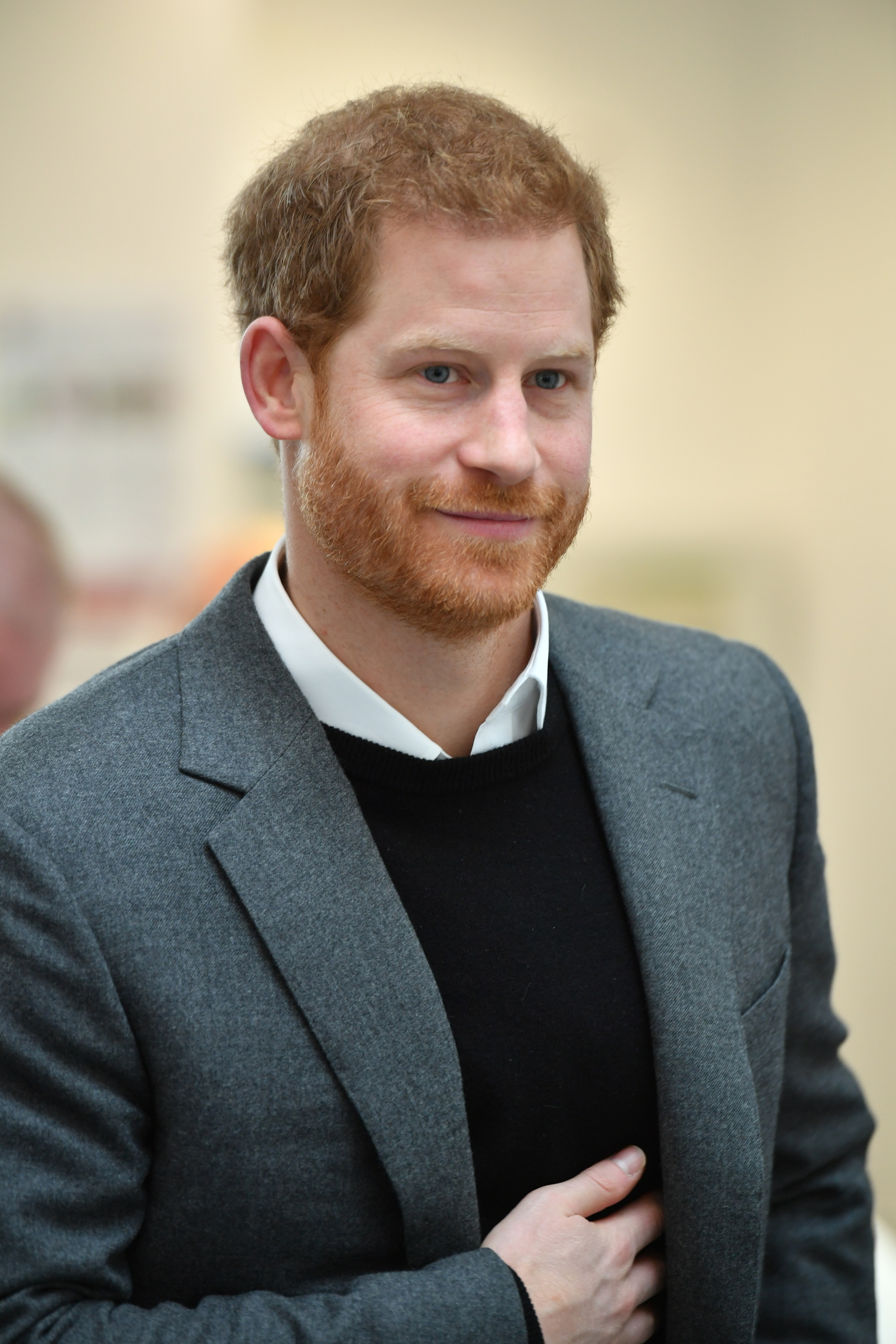 Prince Harry Lost Almost All His Hair