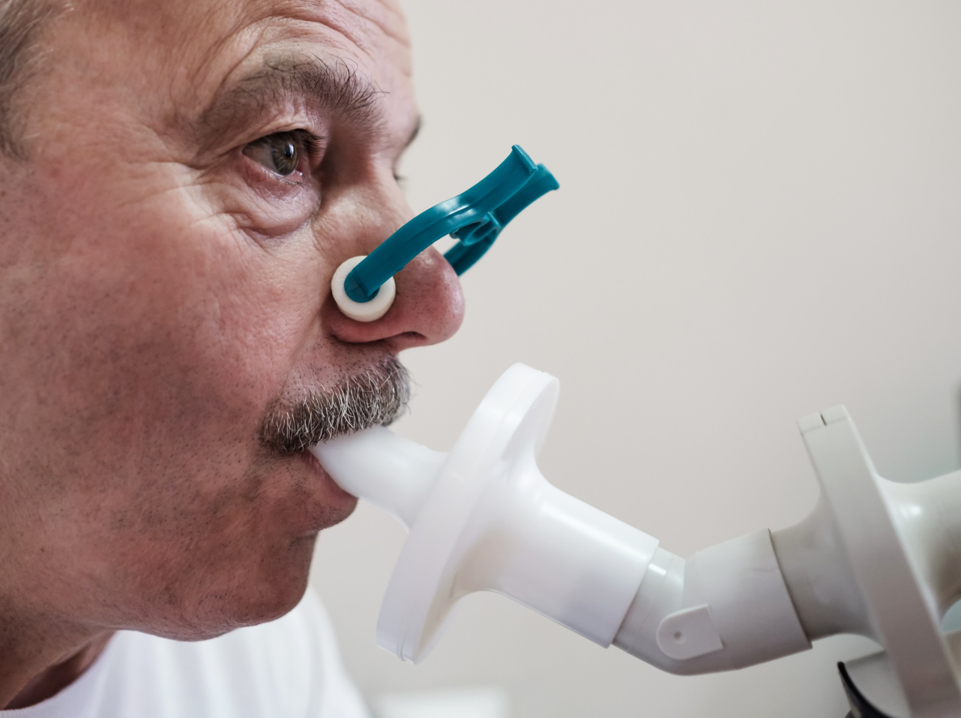 How serious is the inflammatory condition known as sarcoidosis?