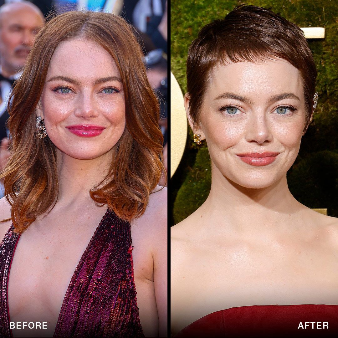 Emma Stone's New Hair, Plus 19 Other Pixie Cut Transformations