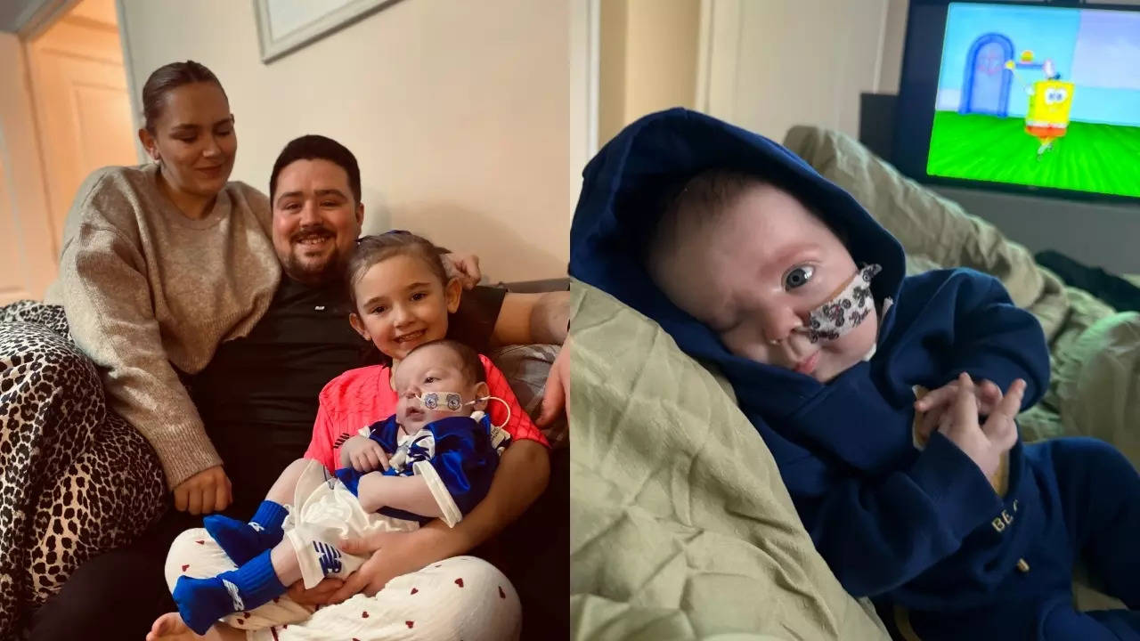 This baby was born with ear on cheek due to a rare condition