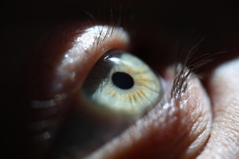 Blind Canadian man has his own tooth surgically implanted in his eye to ...