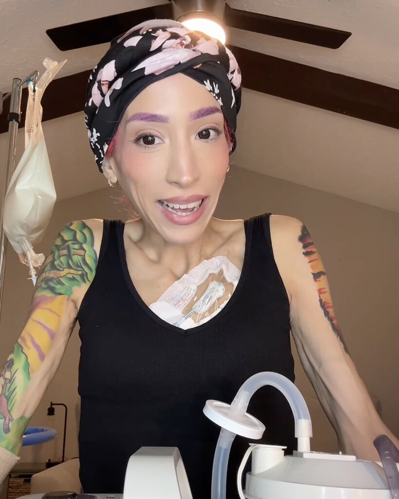 Woman Fighting Cancer Reveals Shocking Reality of Unable to Swallow Her ...