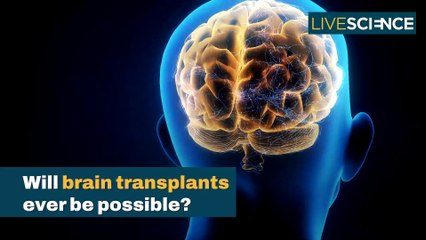 Will Brain Transplants Ever Be Possible?