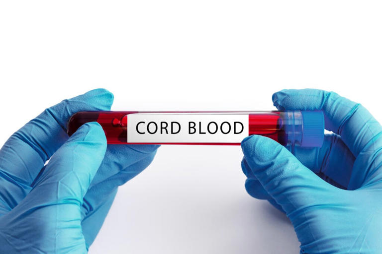 What Is Cord Blood Banking And Why It's Important