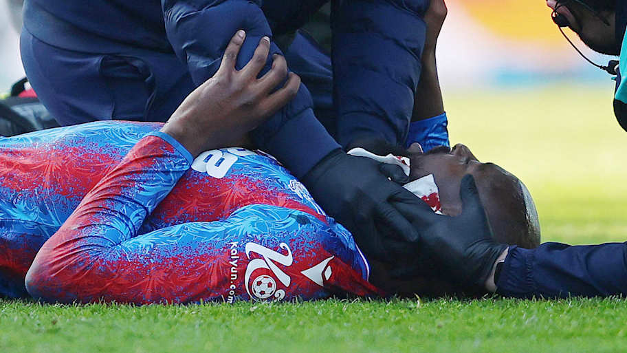 Jean-Philippe Mateta breaks silence after 'life endangering' head injury