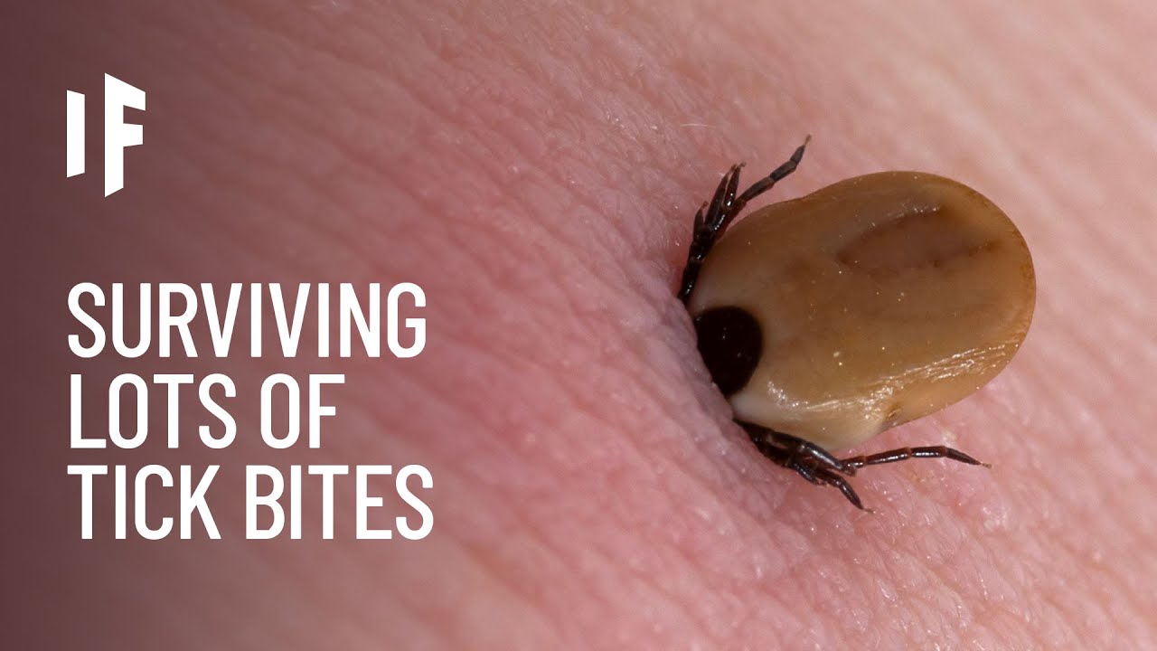 One Million Ticks: Could You Escape the Bite?