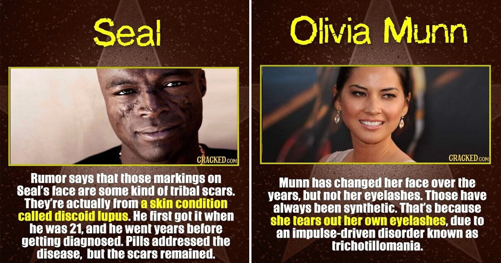 15 Celebs With Iconic Features and The Lesser-Known Reasons Behind Them