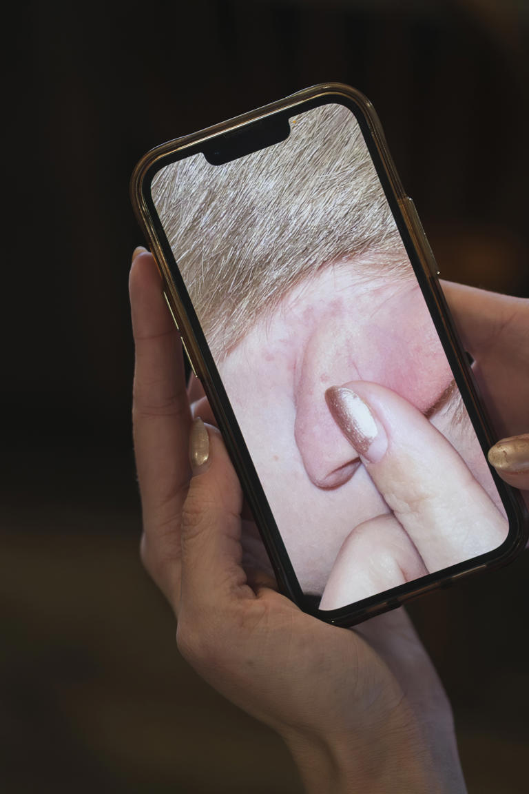 Amid West Texas measles outbreak, vaccine resistance hardens