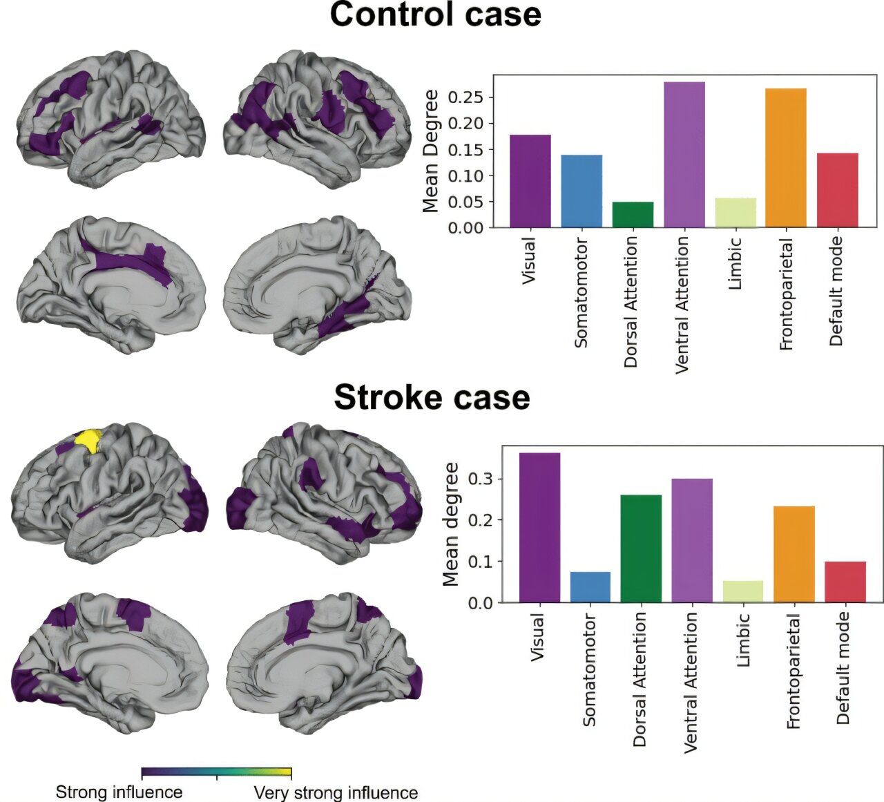 Advancing stroke imaging analysis with interpretable AI and effective ...