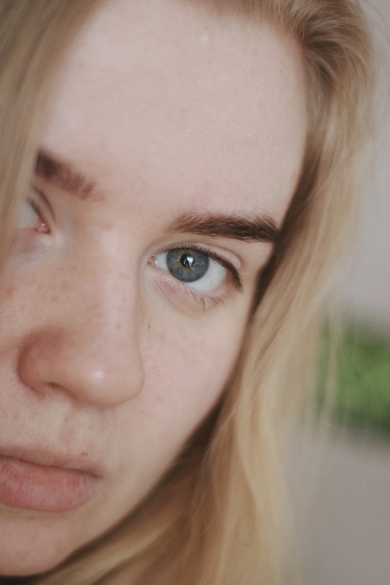 30 Conventionally "Unattractive" Physical Features People Love