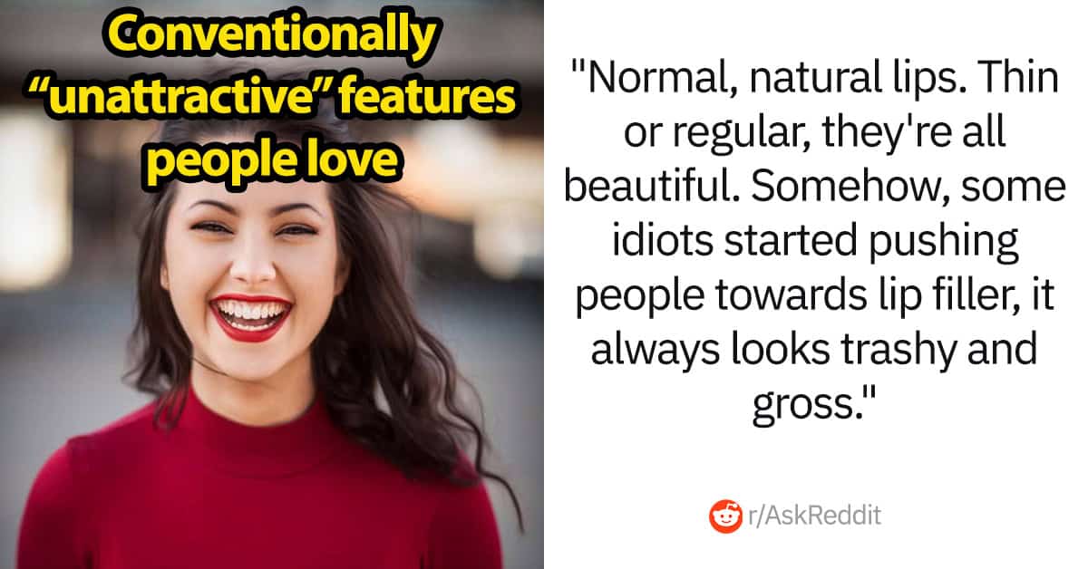 30 Conventionally "Unattractive" Physical Features People Love