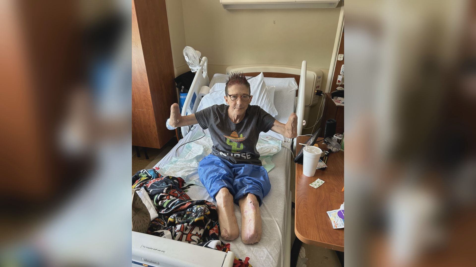 Woman rebuilds after losing arms and legs to sepsis