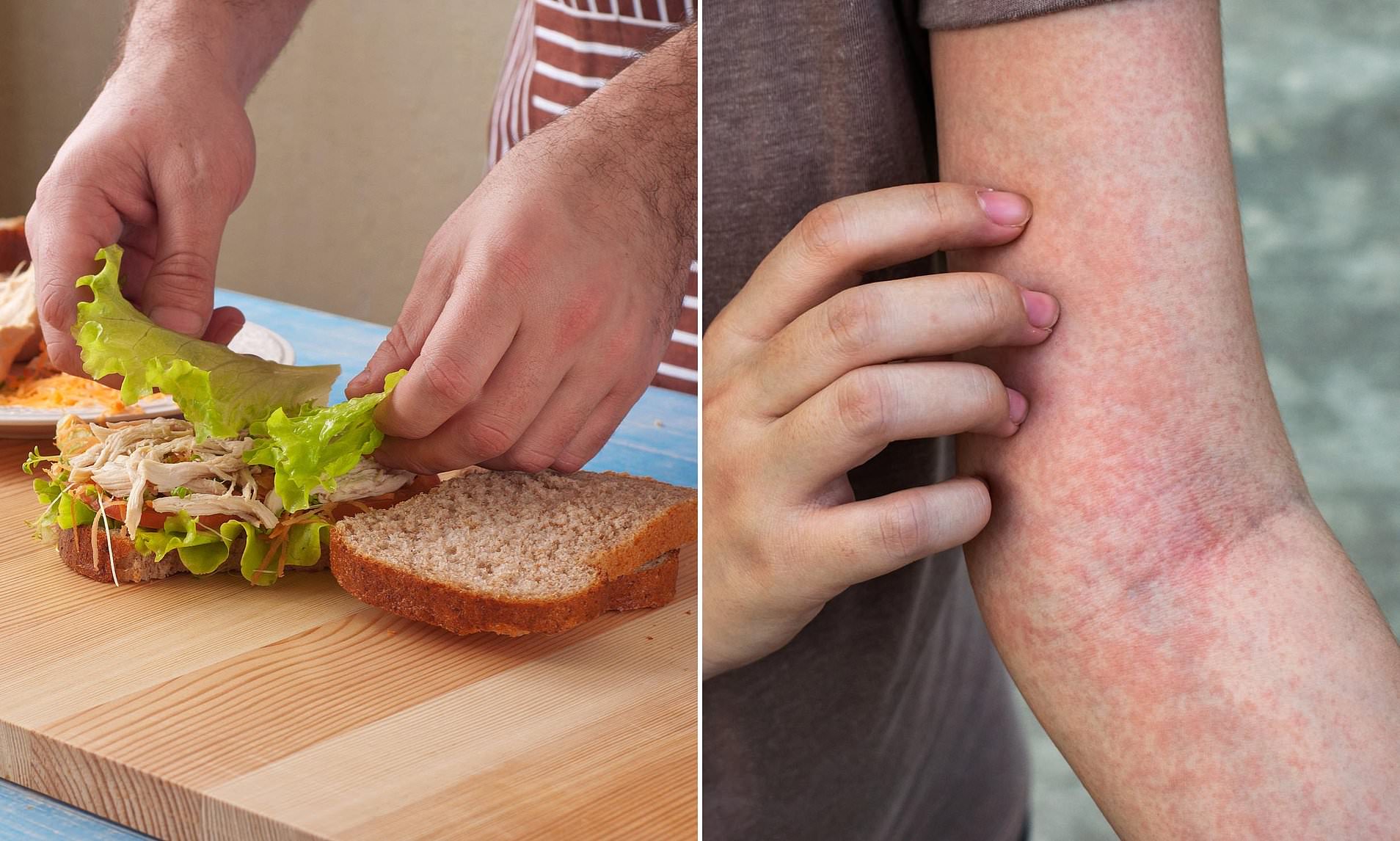 'Do not eat' order issued as popular sandwich topper urgently recalled