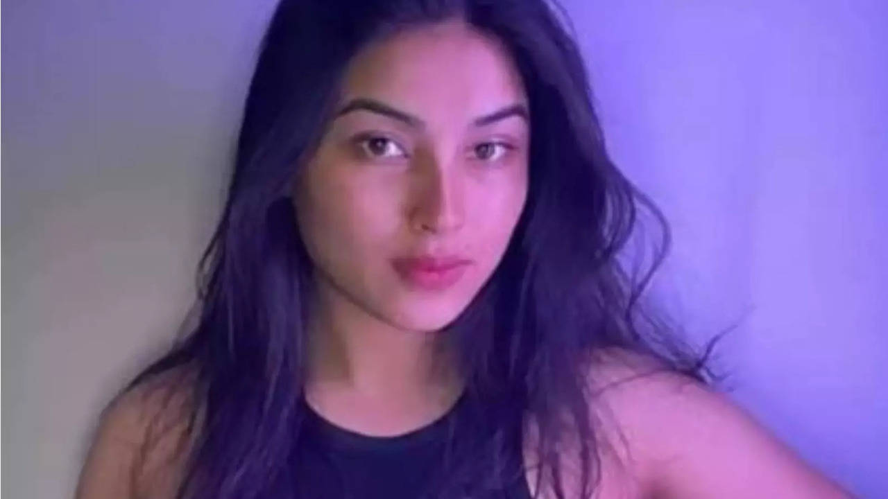 Splitsvilla Fame Akriti Negi Injured While Shooting For Upcoming Song