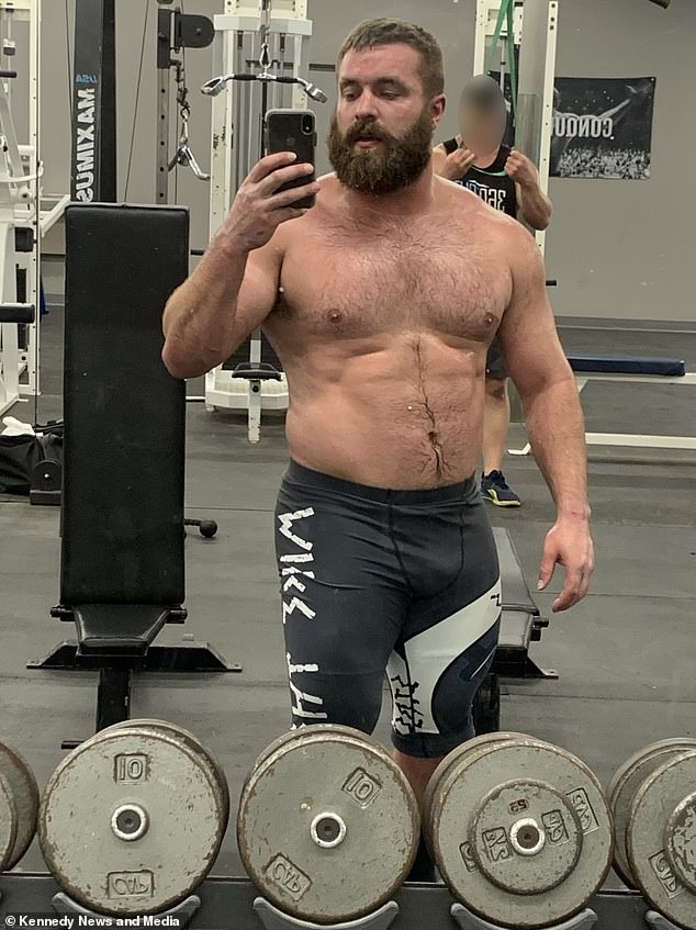 Doctors' warning as two people's biceps 'blow up' while exercising