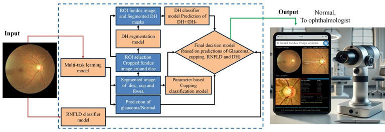 AI Screens Glaucoma in Seconds