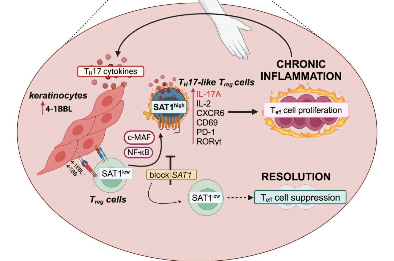 New treatment option for psoriasis restores anti-inflammatory immune ...