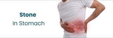 These 5 things turn into stones as soon as they enter the stomach