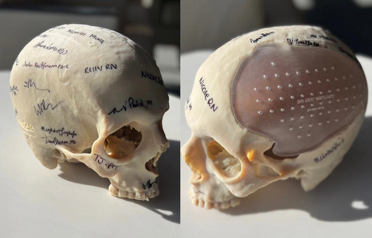 Jersey Shore doctors used 3D printer to replace crumbling part of Brick ...