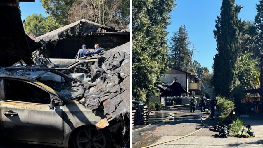 1 severely burned in Santa Rosa carport fire
