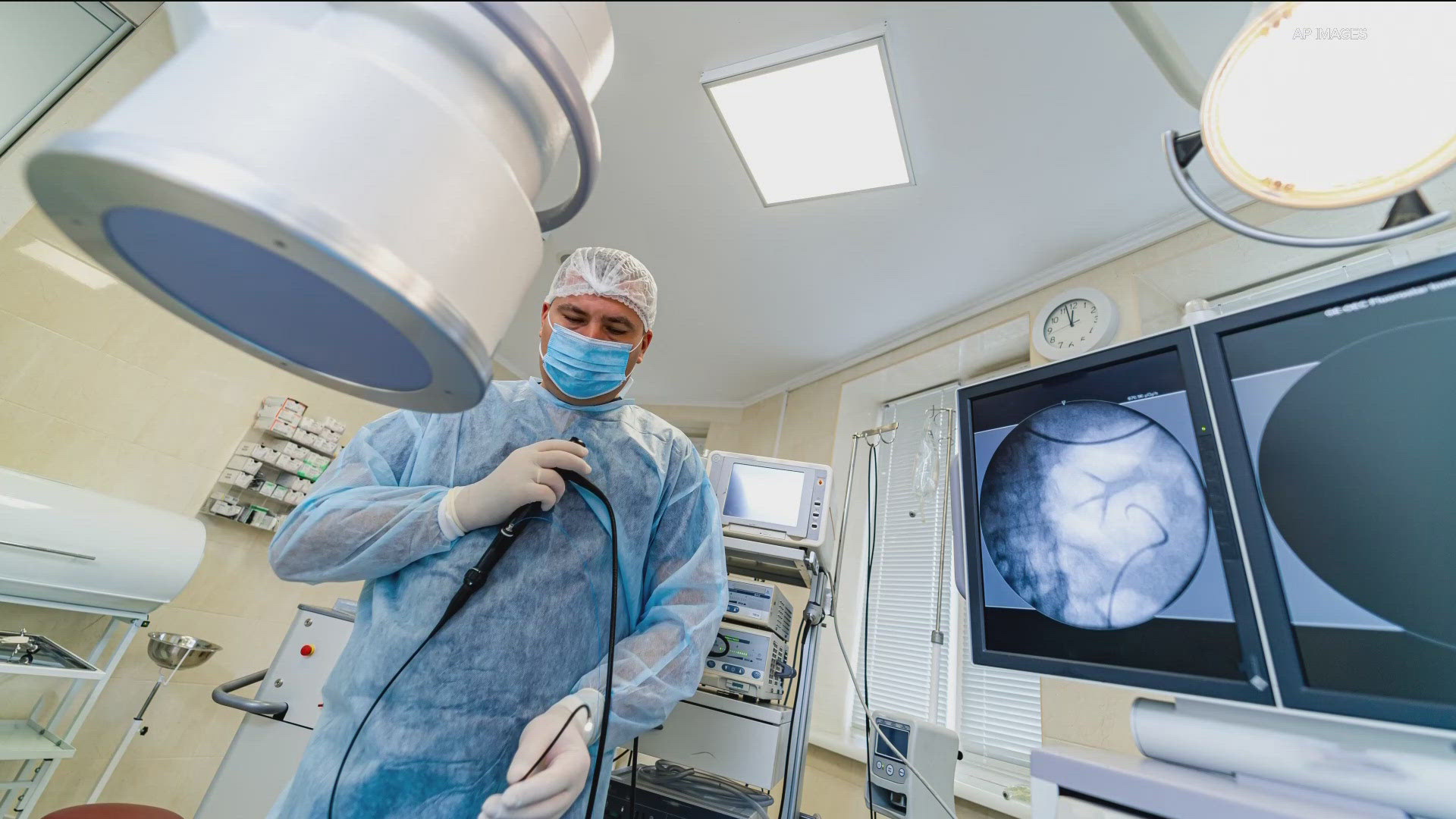 4 most common signs of colorectal cancer