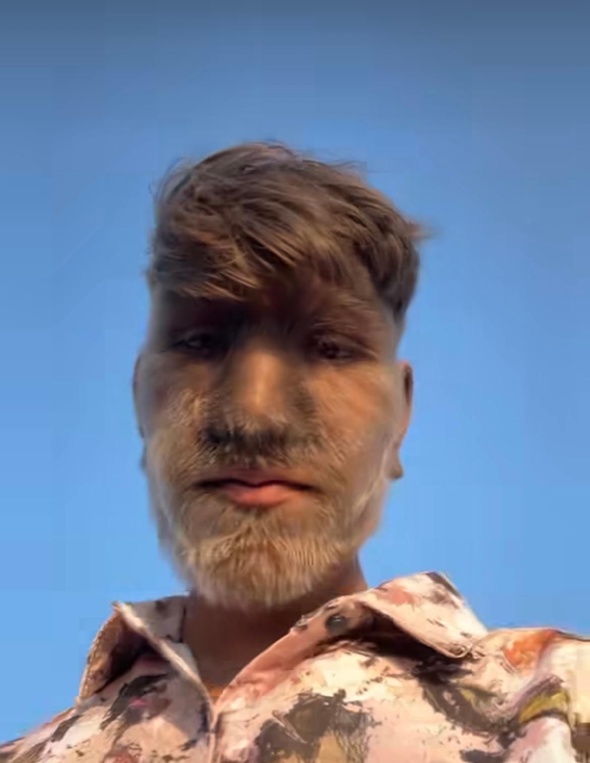 Teen Sets Wild Guinness World Record Thanks To ‘Werewolf Syndrome’