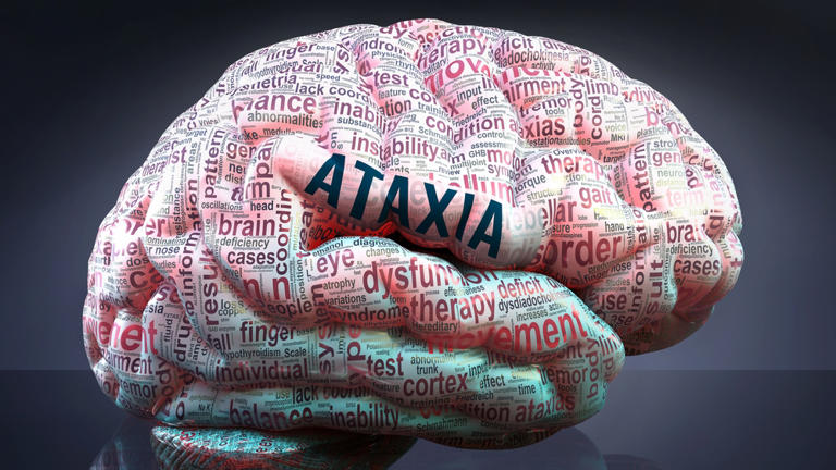 What is ataxia? Doctor explains symptoms triggered by lesions in brain
