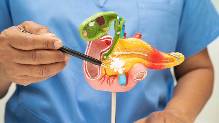 7 Early Warning Signs of Pancreatic Cancer You Shouldn't Ignore