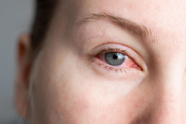 How is pollution actually affecting our health?